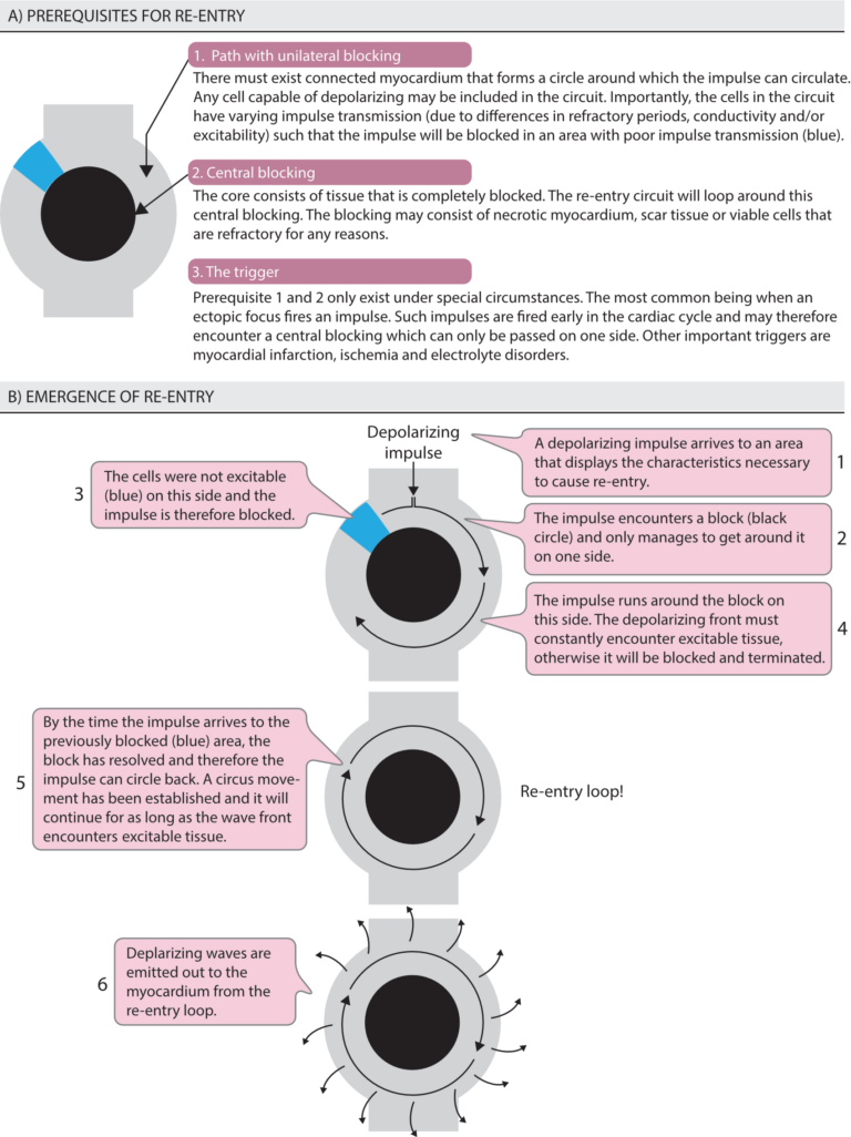 Mechanisms of cardiac arrhythmias: from automaticity to re-entry ...