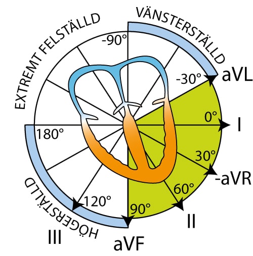 Figur 32. Extremitetsavledningarna och hjärtats el-axel. – ECG learning
