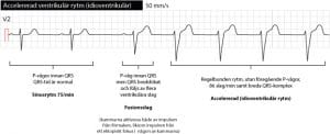 ivr – ECG learning