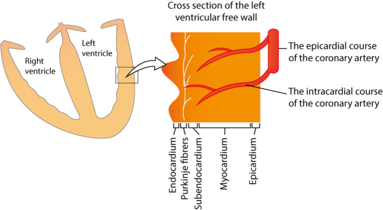 Classification of Acute Coronary Syndromes (ACS) & Acute Myocardial ...