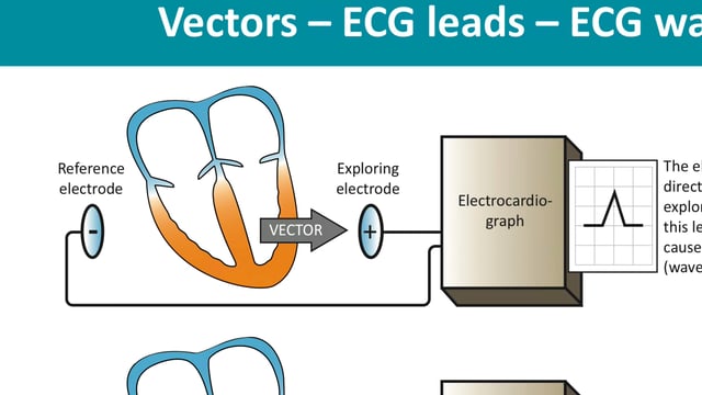 Cardiac electrophysiology: action potential, automaticity and vectors ... Cardiac electrophysiology: action potential, automaticity and vectors ...