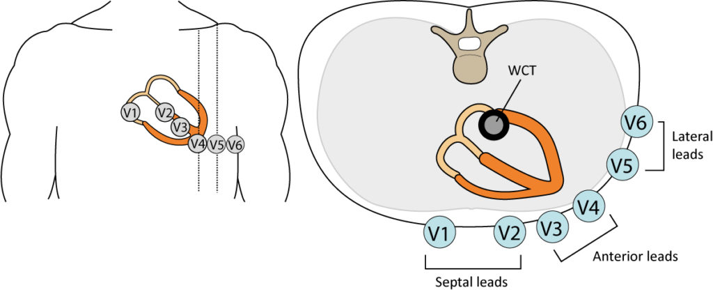 The ECG leads: electrodes, limb leads, chest (precordial) leads, 12 ...