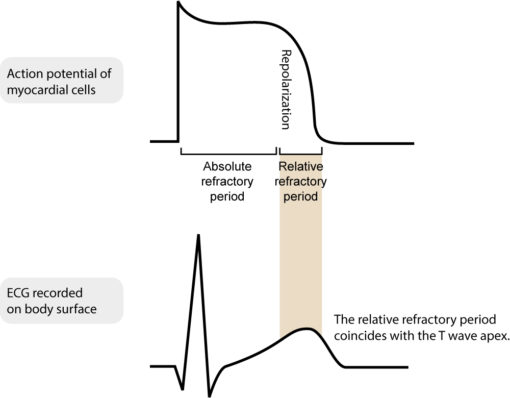 Cardiac electrophysiology: action potential, automaticity and vectors ...