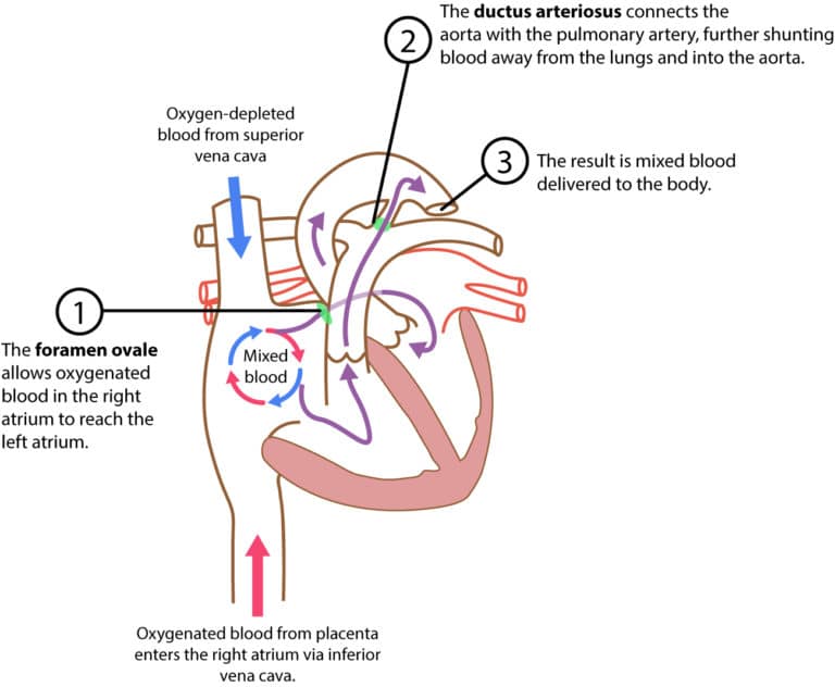 Introduction to pediatric & neonatal ECG interpretation