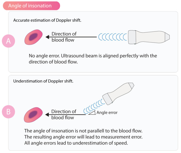 Doppler effect and Doppler echocardiography – The Cardiovascular