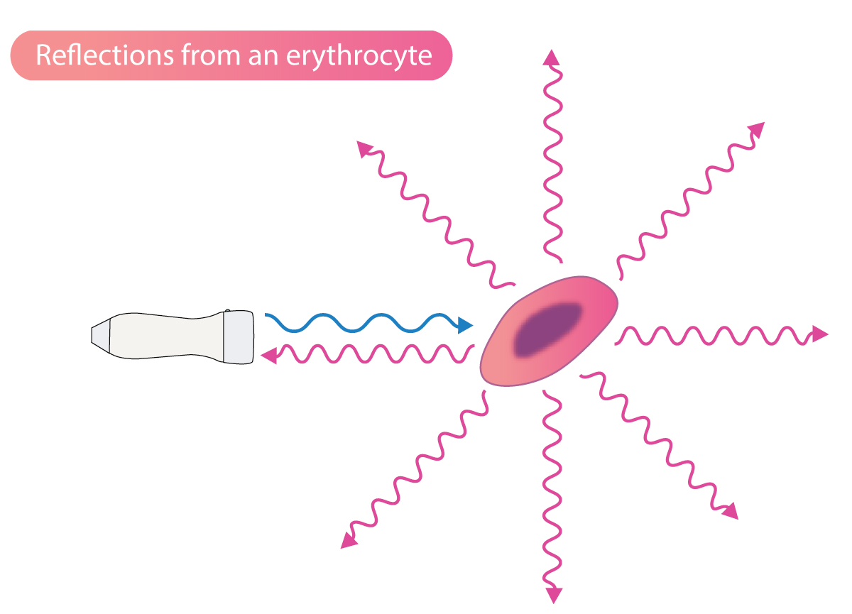Doppler effect and Doppler echocardiography – The Cardiovascular