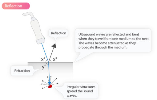 Technical aspects of the ultrasound image – The Cardiovascular