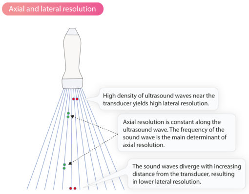 Technical aspects of the ultrasound image – The Cardiovascular