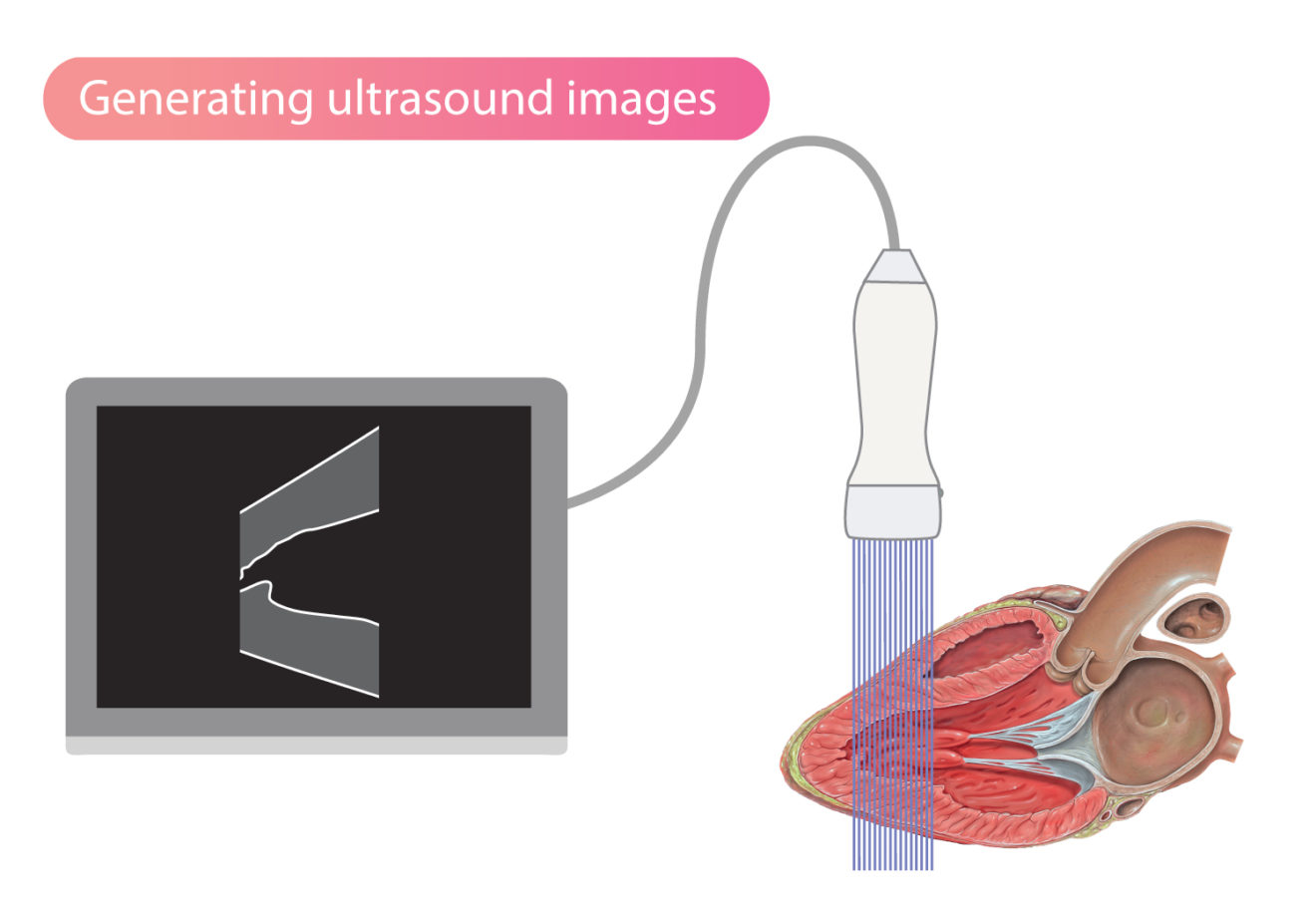 Technical aspects of the ultrasound image – The Cardiovascular