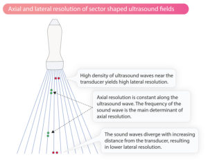 Two-dimensional (2D) echocardiography – The Cardiovascular