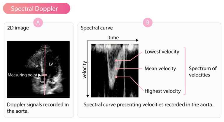 Doppler effect and Doppler echocardiography – The Cardiovascular