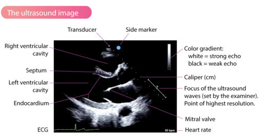 Two-dimensional (2D) echocardiography – The Cardiovascular