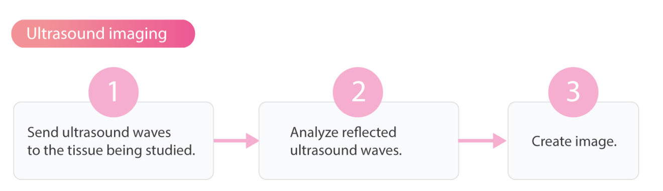 The ultrasound transducer – The Cardiovascular