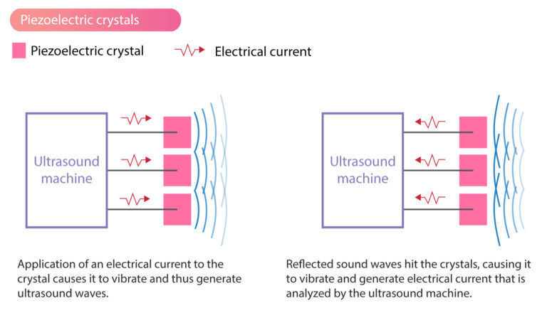 The ultrasound transducer – The Cardiovascular