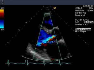 Color Doppler – The Cardiovascular