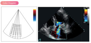 Color Doppler – The Cardiovascular