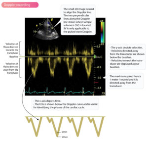 Doppler effect and Doppler echocardiography – The Cardiovascular