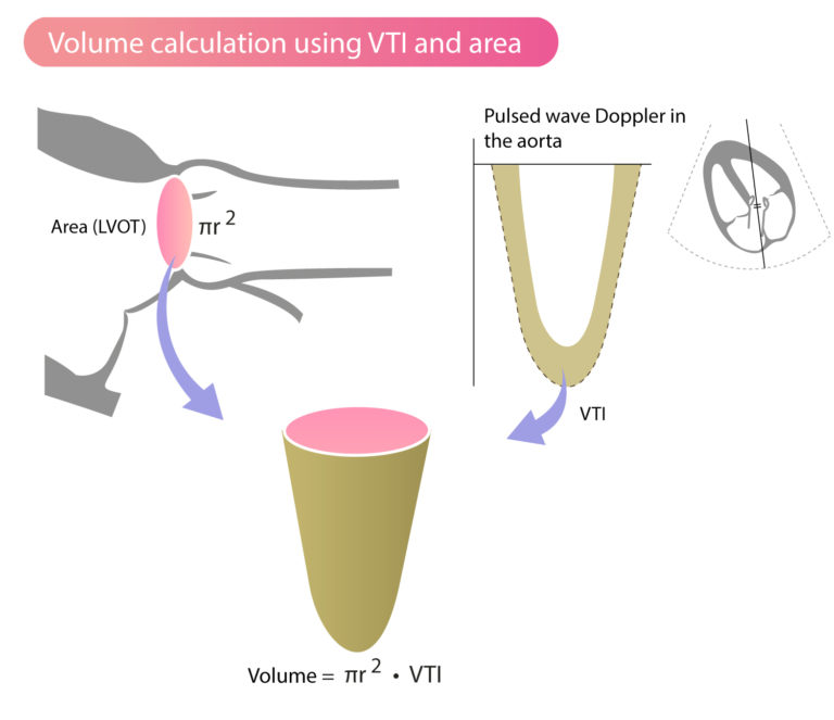 Stroke Volume, VTI (Velocity Time Integral) & Cardiac Output – The ...