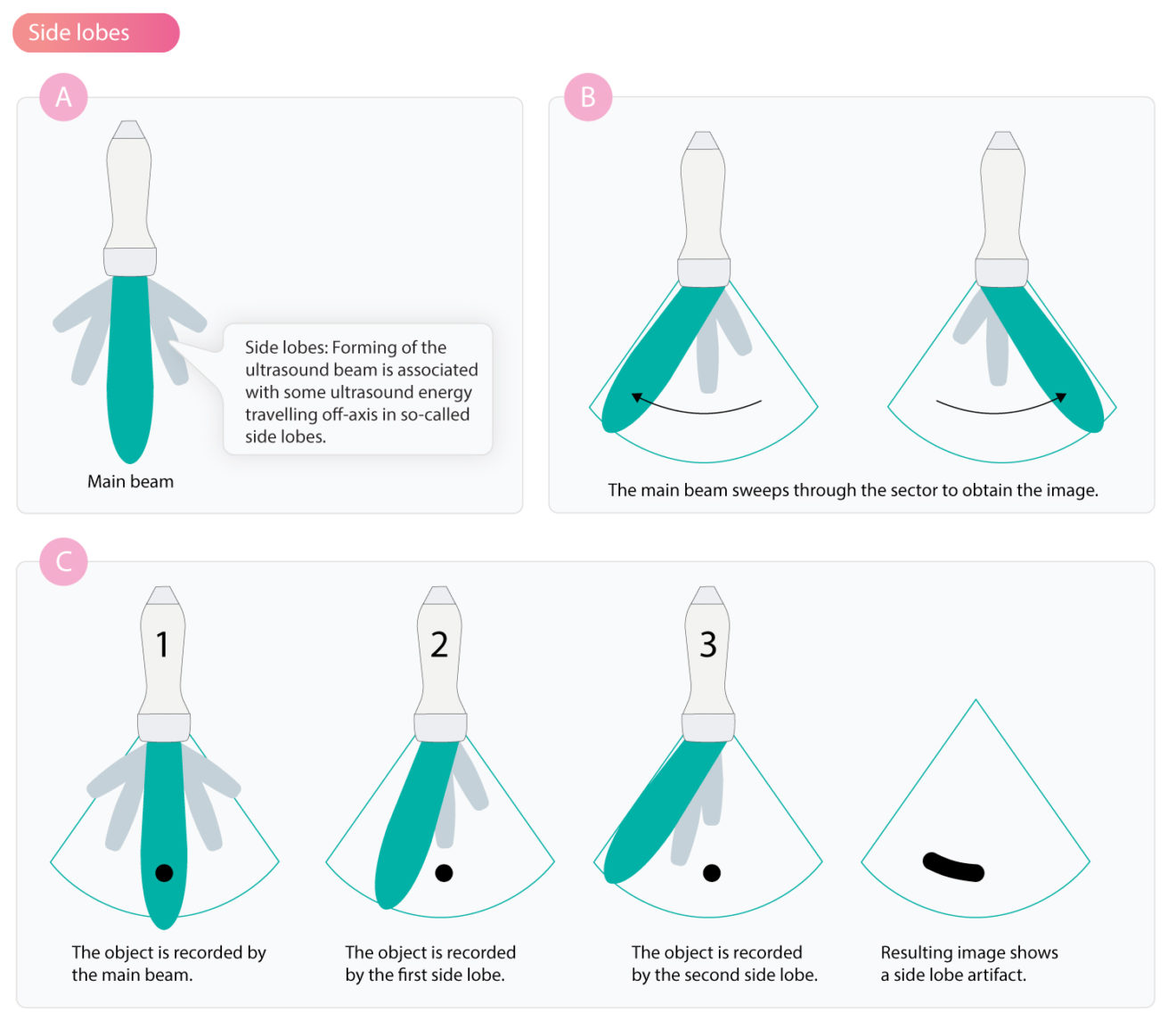 Artifacts in ultrasound imaging – The Cardiovascular