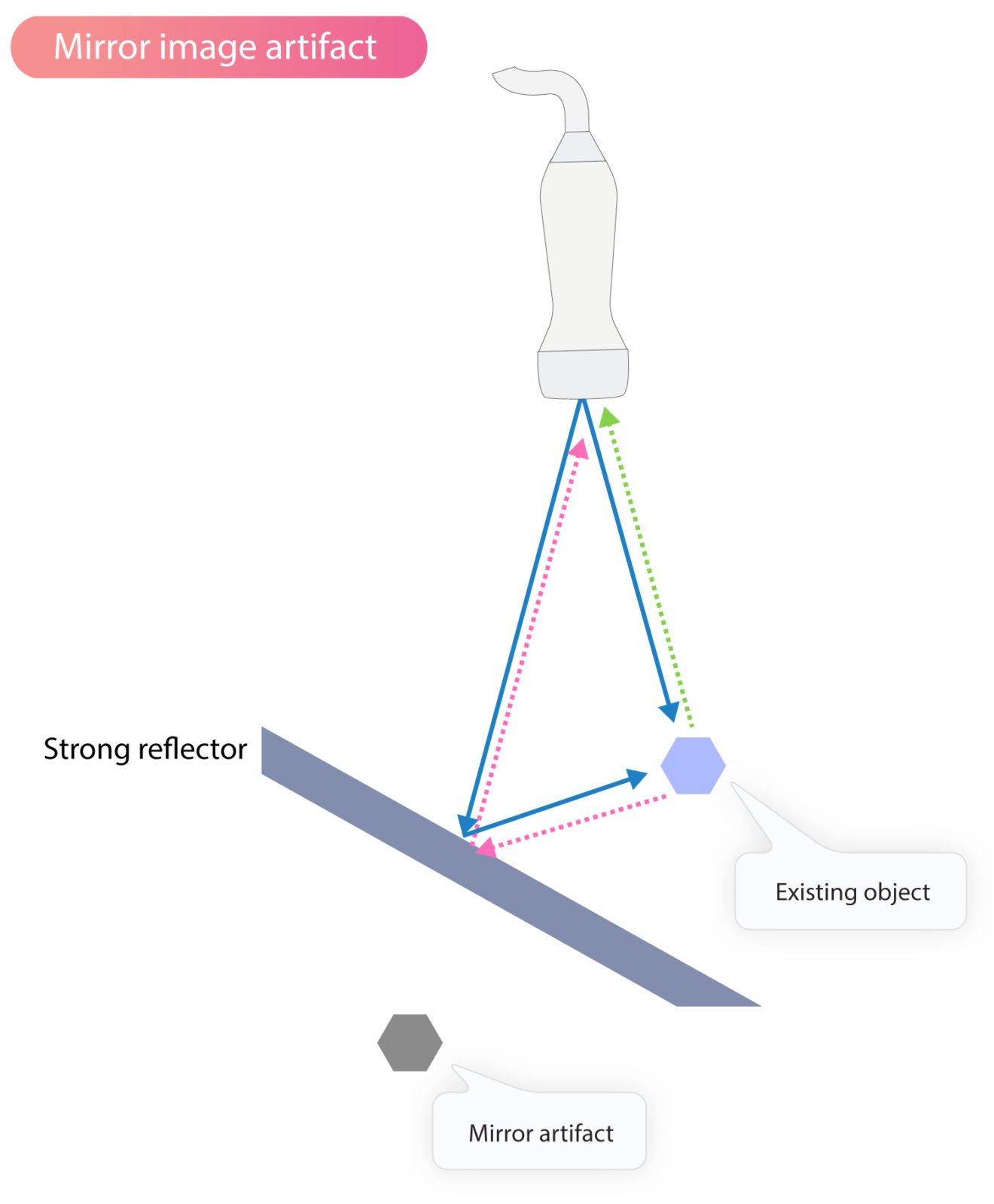 Artifacts in ultrasound imaging – The Cardiovascular