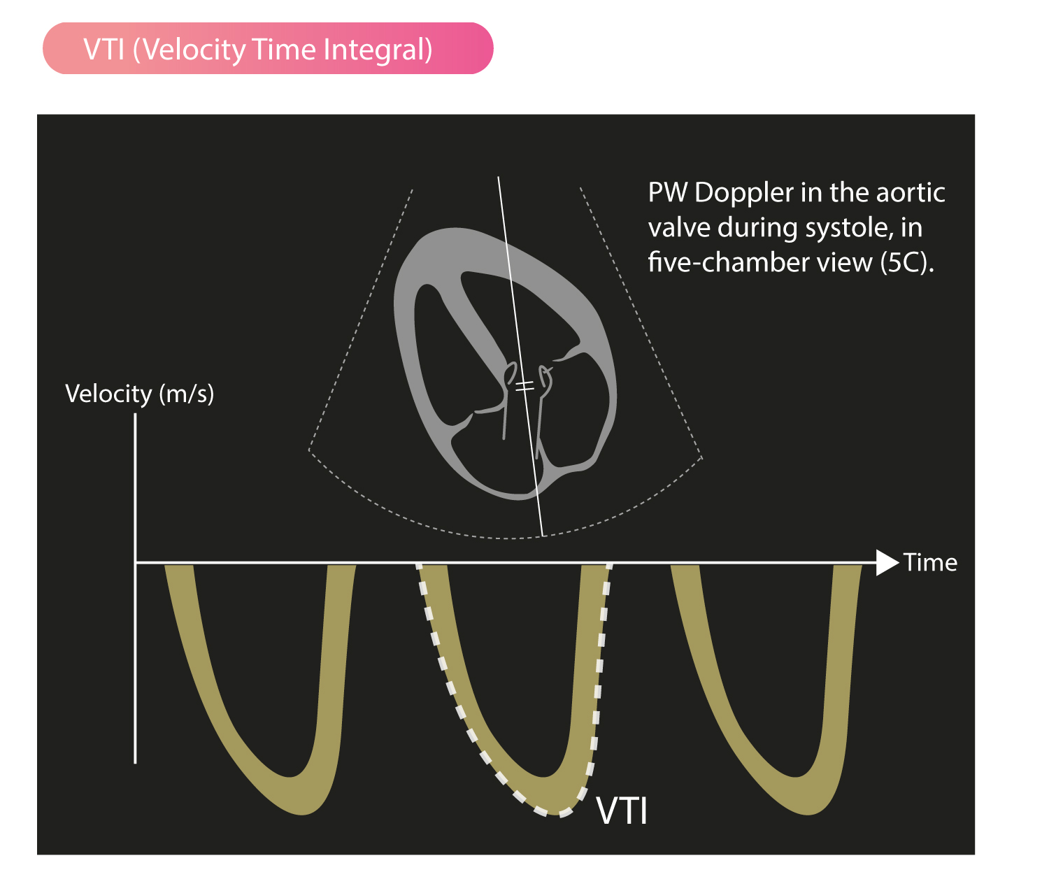 Stroke Volume, VTI (Velocity Time Integral) & Cardiac Output – The ...