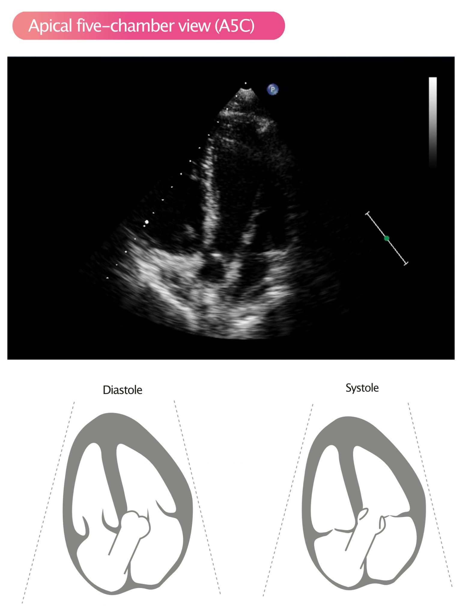 Standard Transthoracic Echocardiogram: Complete Imaging Protocol – ECG & ECHO