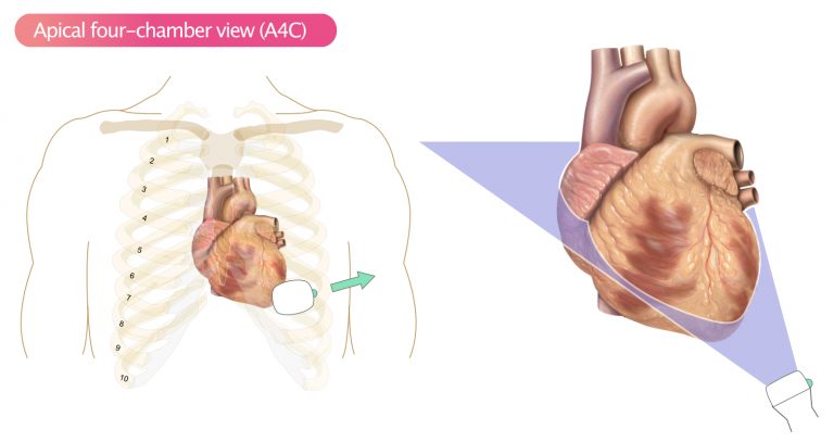 Standard Transthoracic Echocardiogram: Complete Imaging Protocol ...