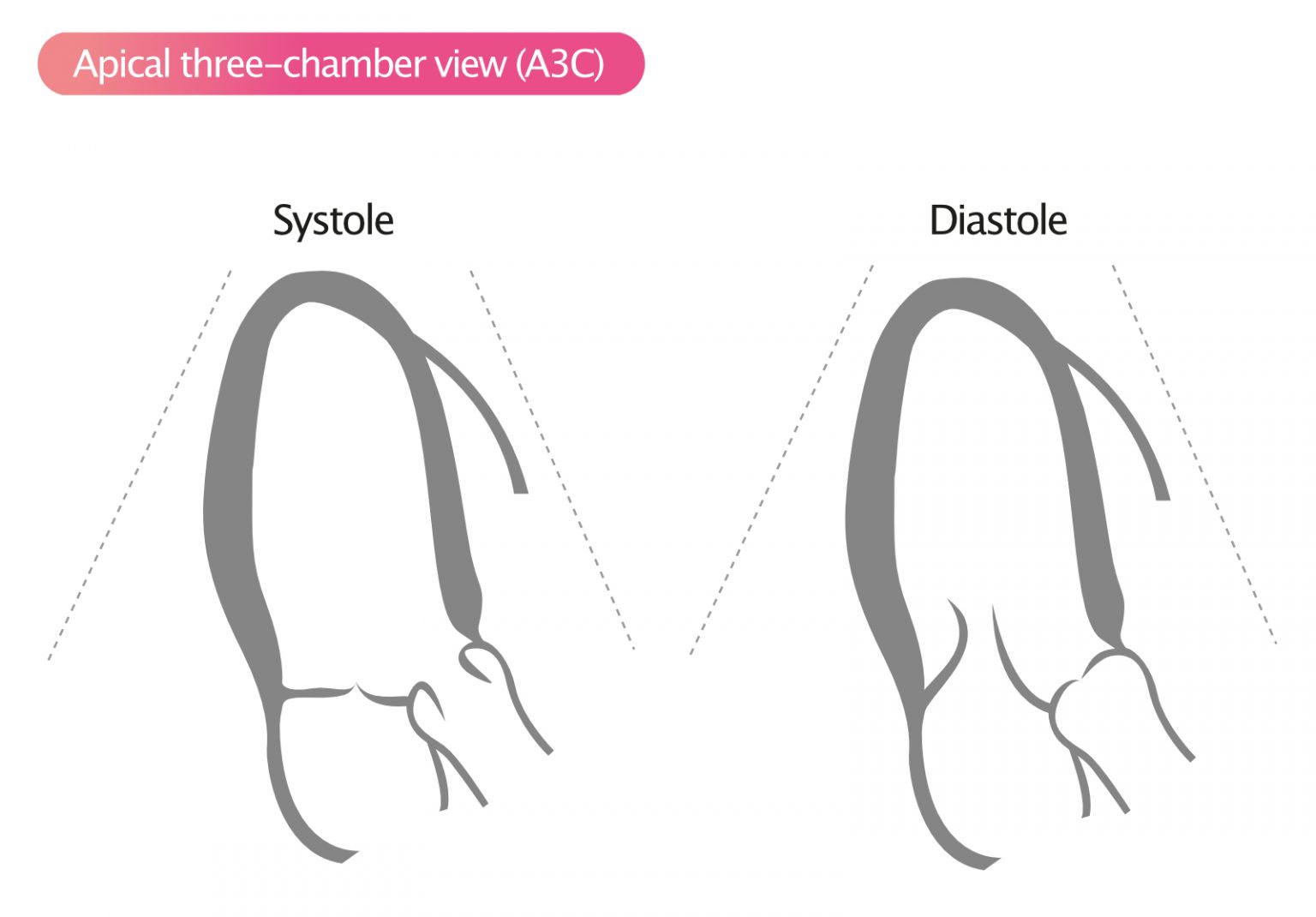 Standard Transthoracic Echocardiogram: Complete Imaging Protocol – ECG ...