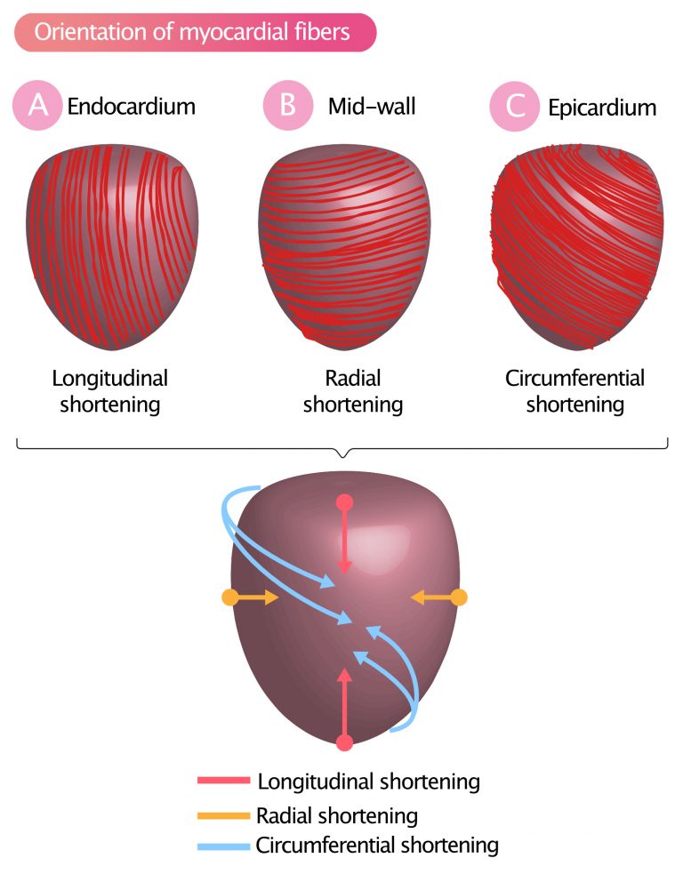 Strain, strain rate and speckle tracking: Myocardial deformation – The ...