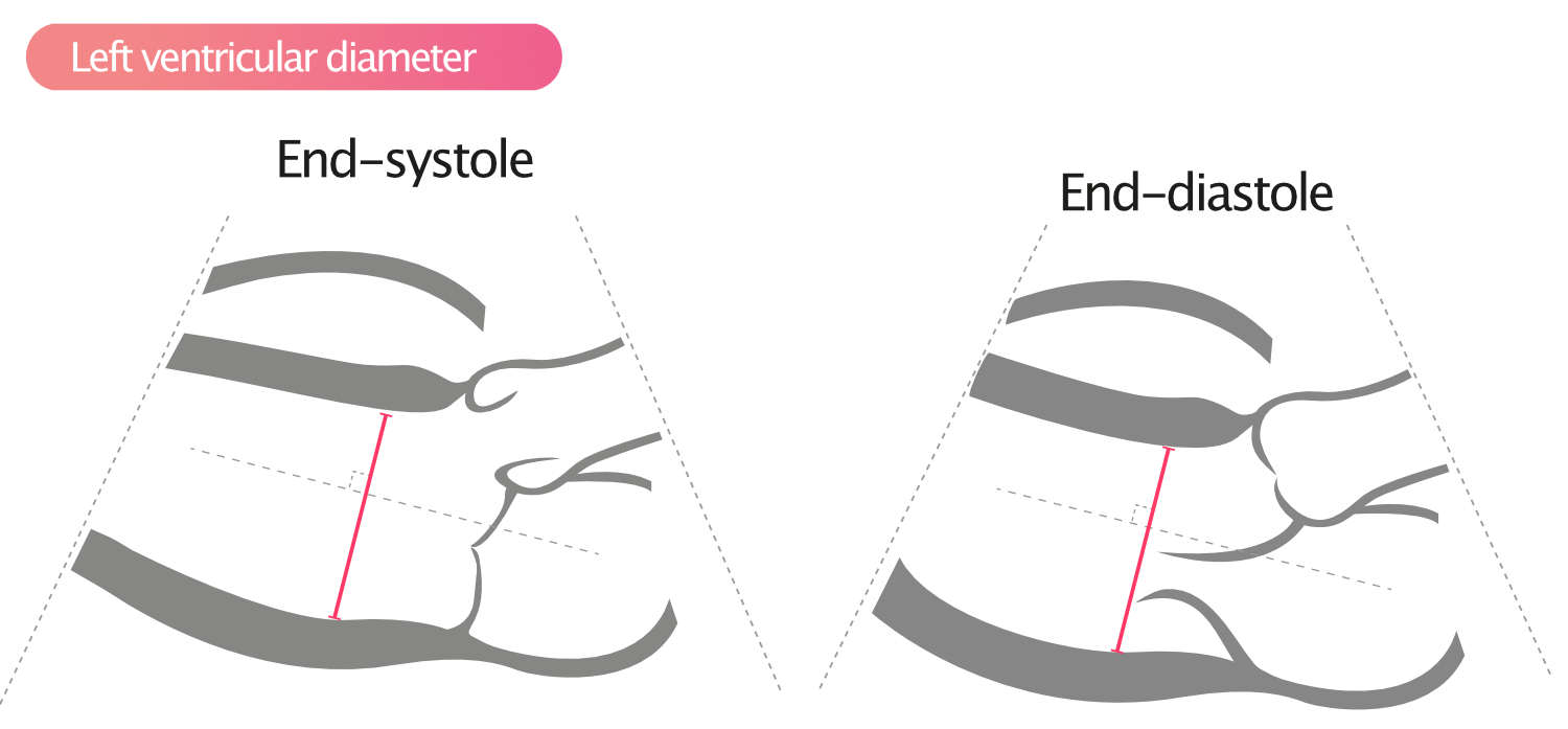 Standard Transthoracic Echocardiogram: Complete Imaging Protocol – ECG ...