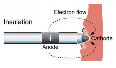 Components and construction of a pacemaker – The Cardiovascular