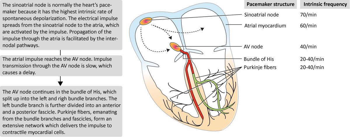 Introduction to Cardiac Pacing and Devices: Pacemaker, ICD, CRT ...