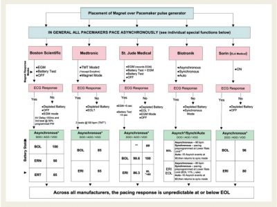 Basic cardiac pacing, pacemaker functions and settings – Cardiovascular Education