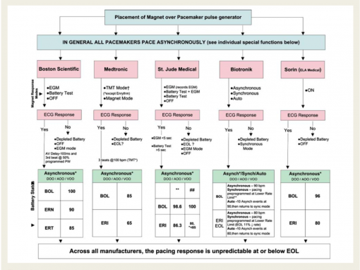 Basic cardiac pacing, pacemaker functions and settings – Cardiovascular ...