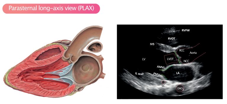 Standard Transthoracic Echocardiogram: Complete Imaging Protocol ...