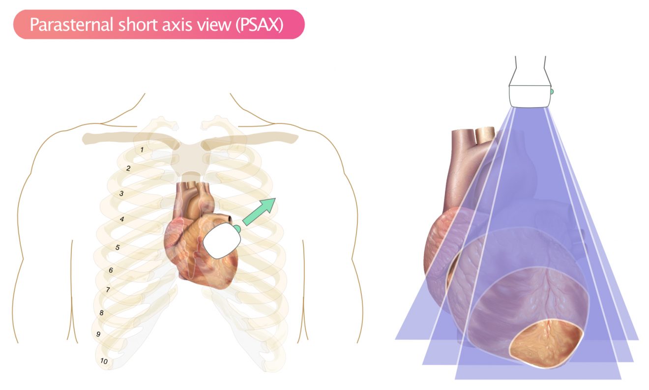 Standard Transthoracic Echocardiogram: Complete Imaging Protocol ...