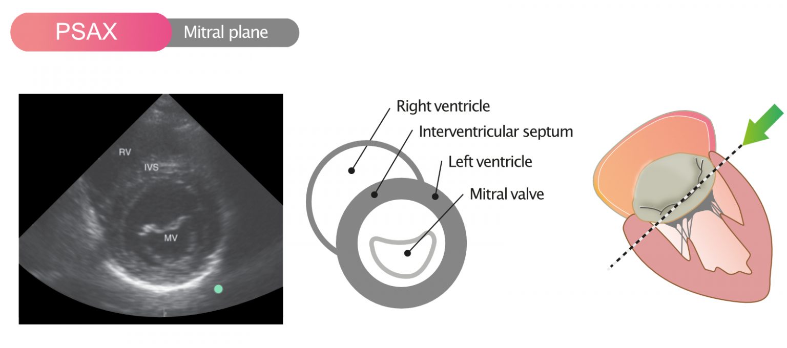 Standard Transthoracic Echocardiogram: Complete Imaging Protocol ...