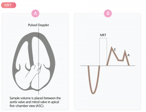 Assessment of diastolic function by echocardiography – The Cardiovascular