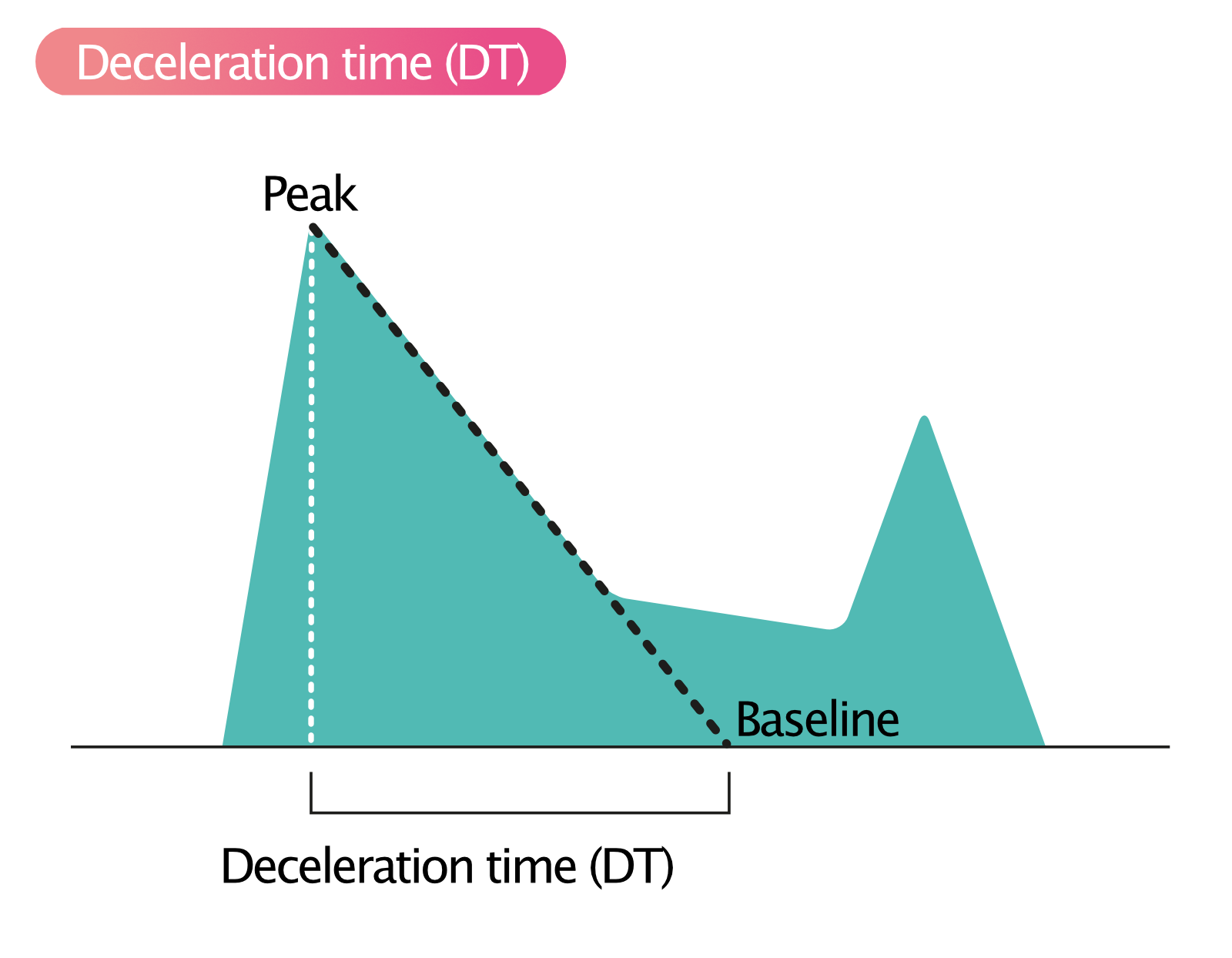 Assessment of diastolic function by echocardiography – The Cardiovascular