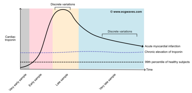 Cardiac troponin I (TnI) and T (TnT): Interpretation and evaluation in ...