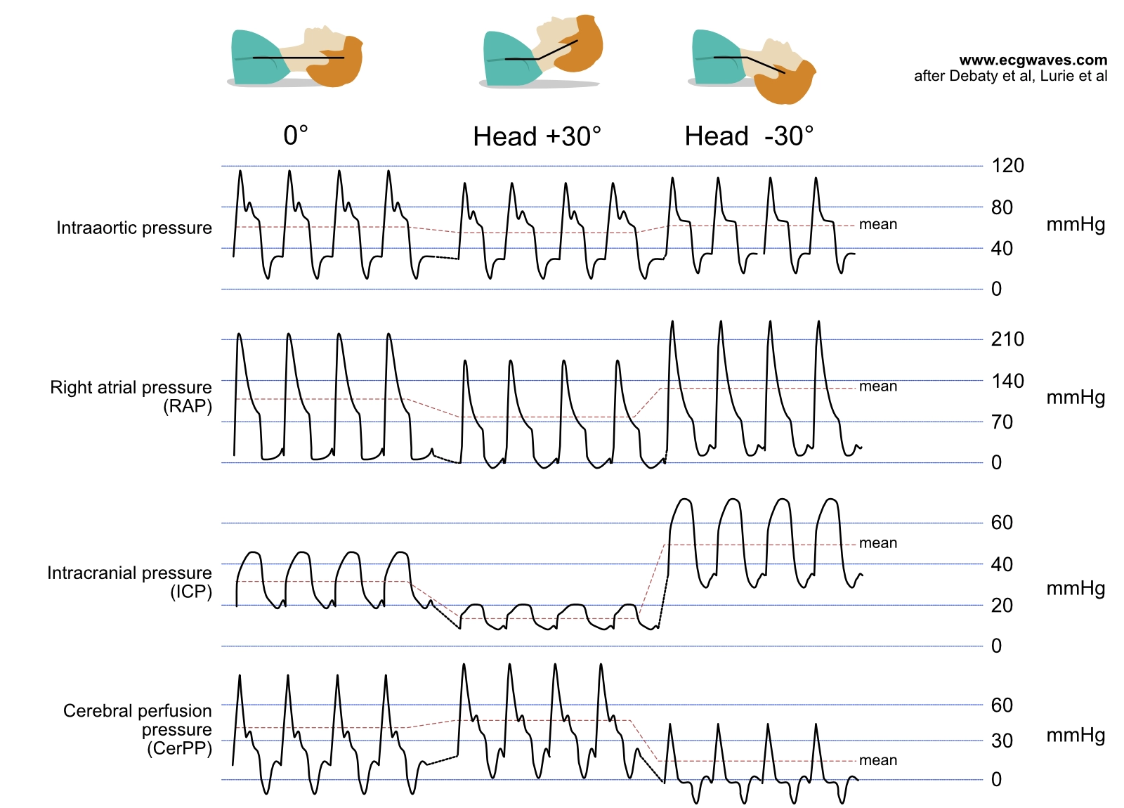 The Physiology Of Cardiopulmonary Resuscitation CPR ECG ECHO The Physiology Of Cardiopulmonary Resuscitation CPR ECG ECHO