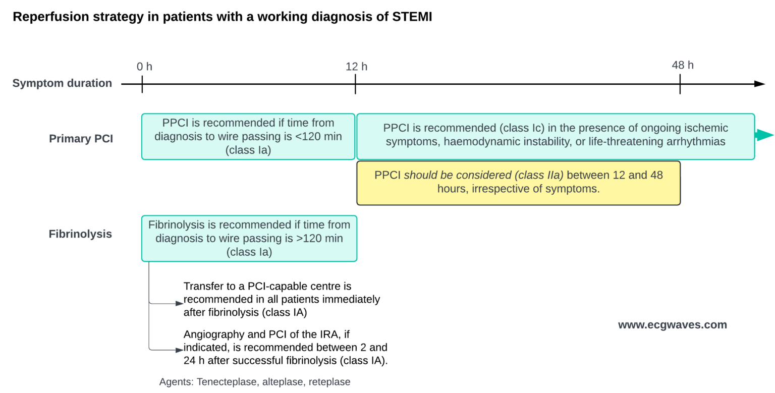 STEMI (ST Elevation Myocardial Infarction): Diagnosis, ECG, Criteria ...