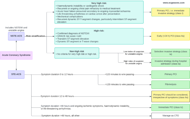 STEMI (ST Elevation Myocardial Infarction): Diagnosis, ECG, Criteria ...