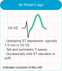 A New Approach to Acute Coronary Syndromes: Occlusion MI (OMI) vs. non ...