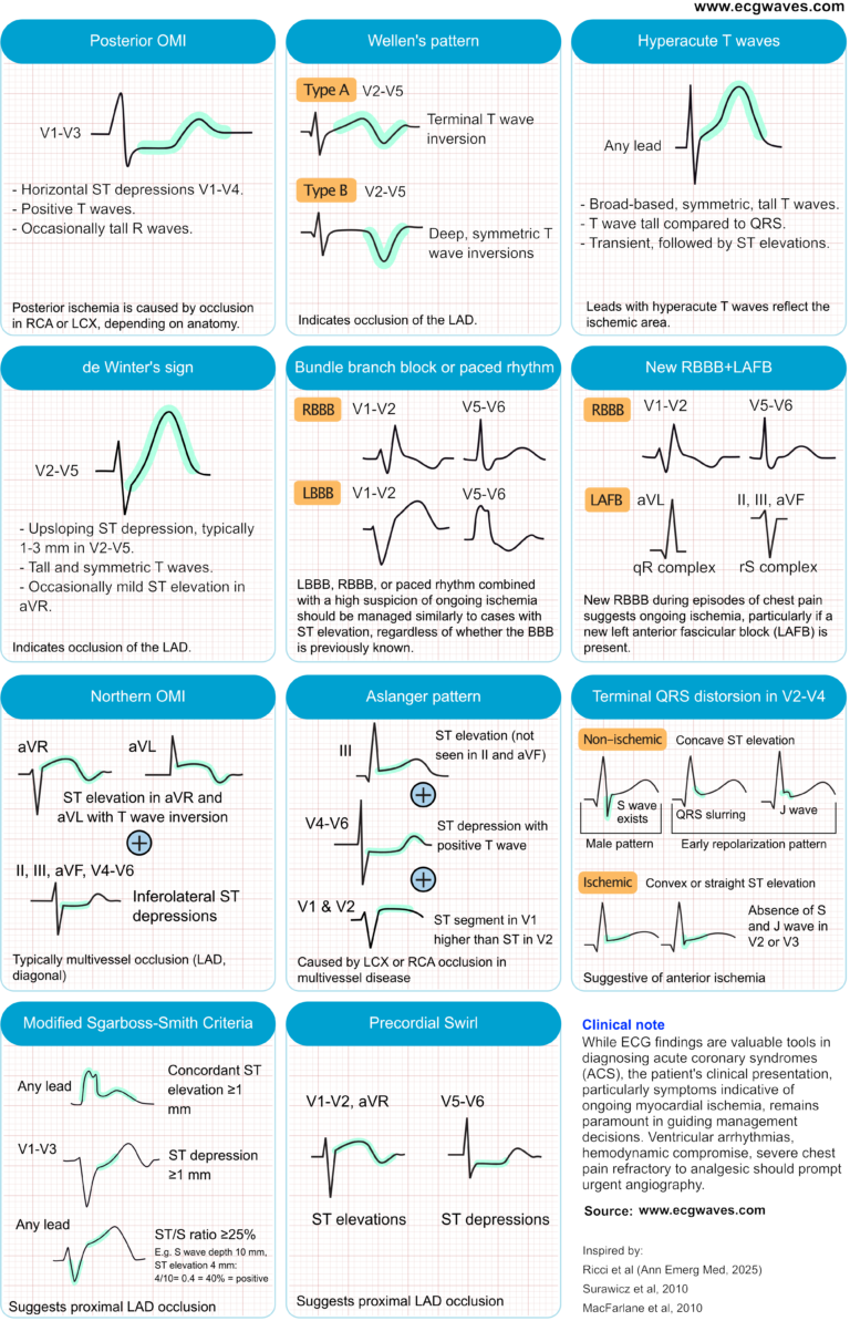 A New Approach to Acute Coronary Syndromes: Occlusion MI (OMI) vs. non ...