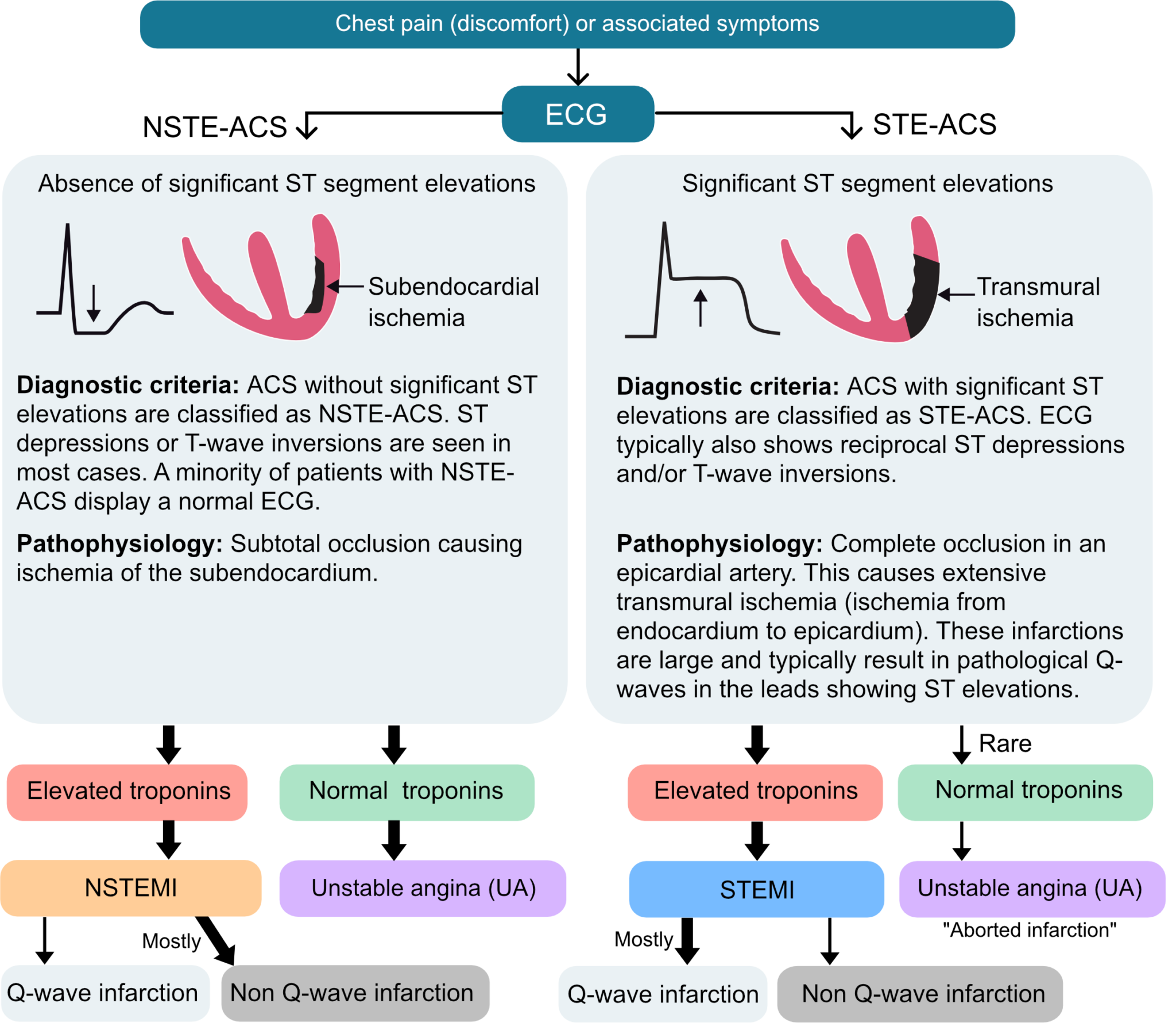 A New Approach to Acute Coronary Syndromes: Occlusion MI (OMI) vs. non ...