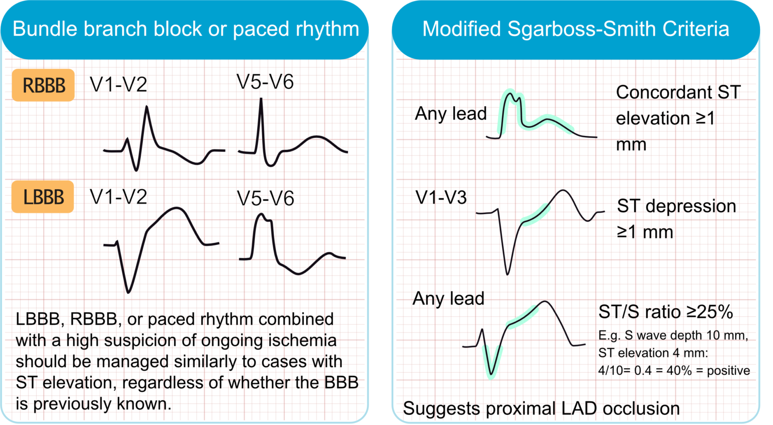 A New Approach to Acute Coronary Syndromes: Occlusion MI (OMI) vs. non ...