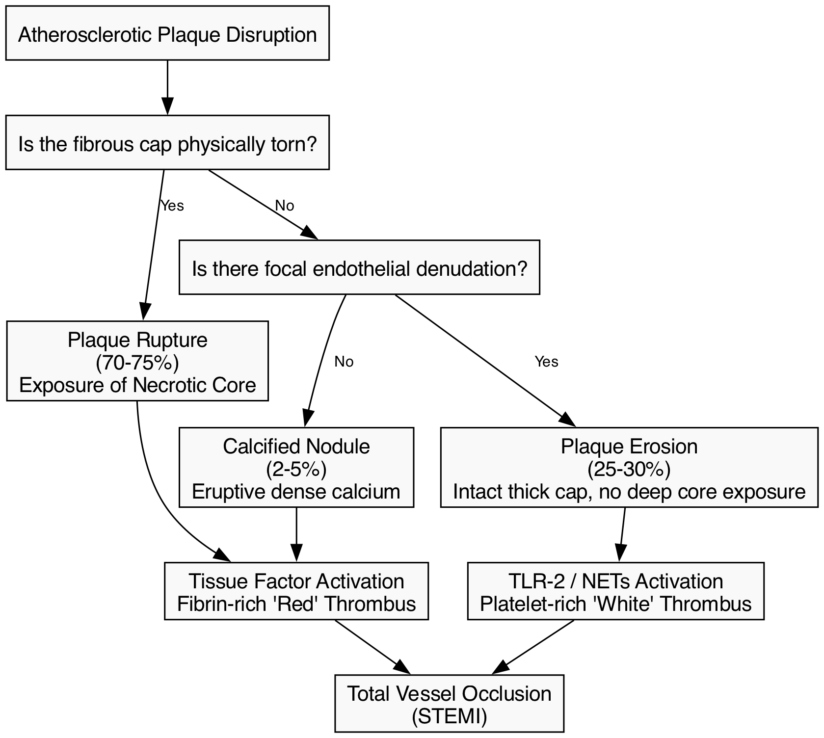 ST-Elevation Myocardial Infarction (STEMI): Pathophysiology, Diagnosis ...